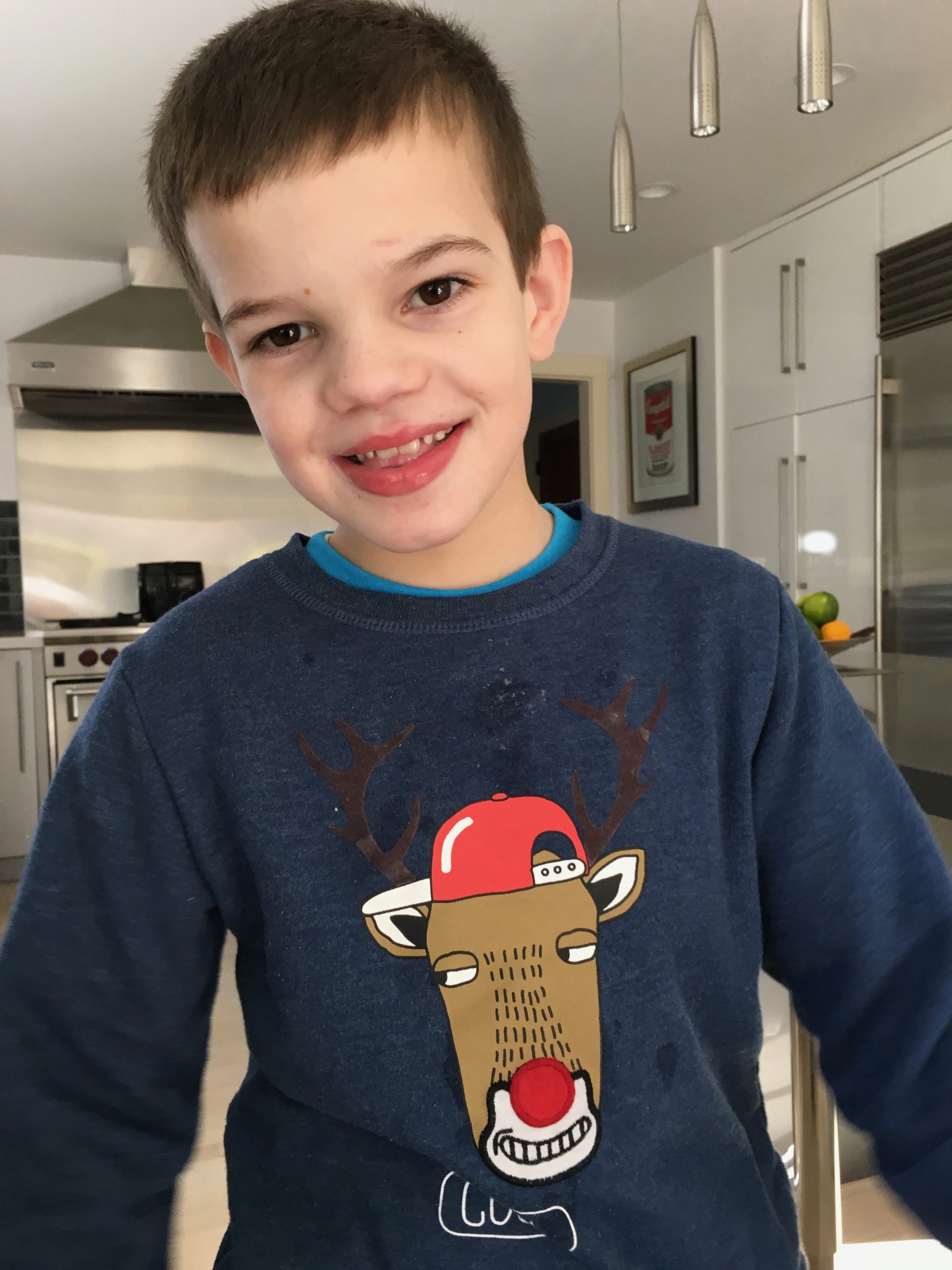 Luke Segars - Autism BrainNet