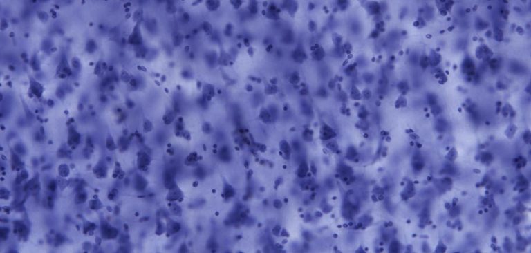 Autism BrainNet to digitize the Autism Celloidin Libray of postmortem ...