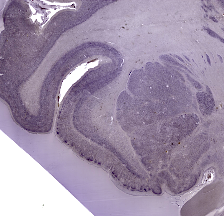 Autism BrainNet to digitize the Autism Celloidin Libray of postmortem ...